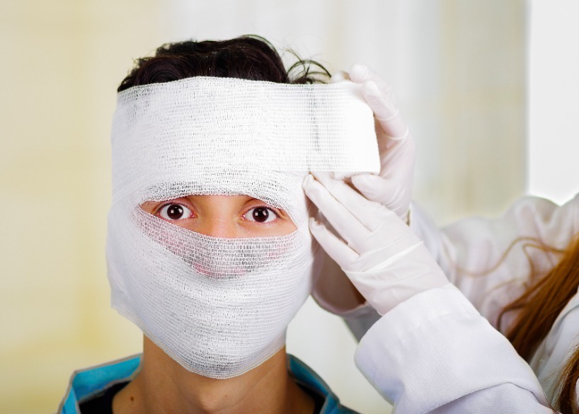 Head Injury Claims - How To Claim Compensation - How To Sue