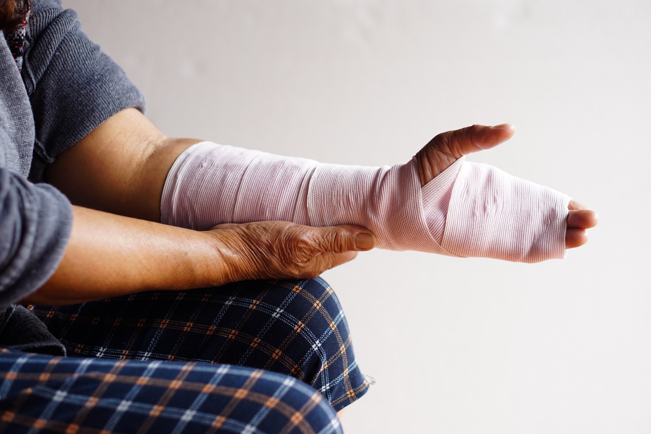 How To Sue For A Hand Injury At Work - Compensation Amounts